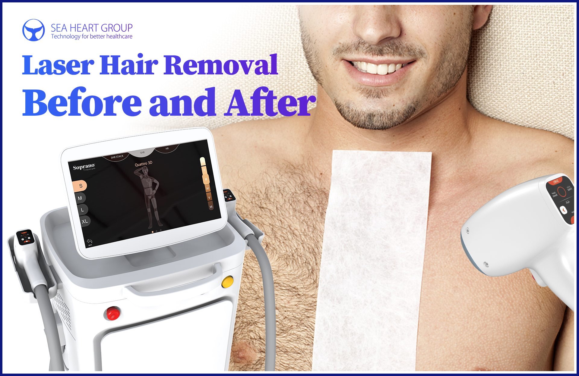 Laser Hair Removal Before and After: What to Expect and How It Works?
